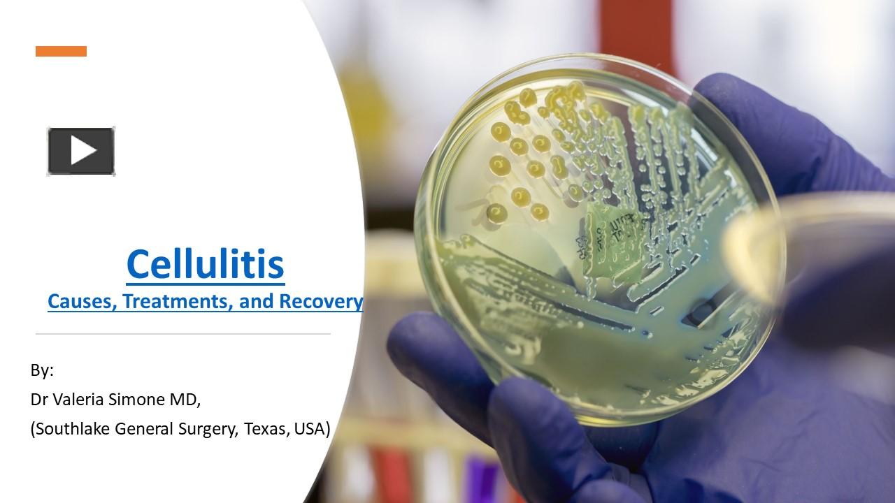 Cellulitis: Causes, Treatments, and Recovery presentation | free to ...