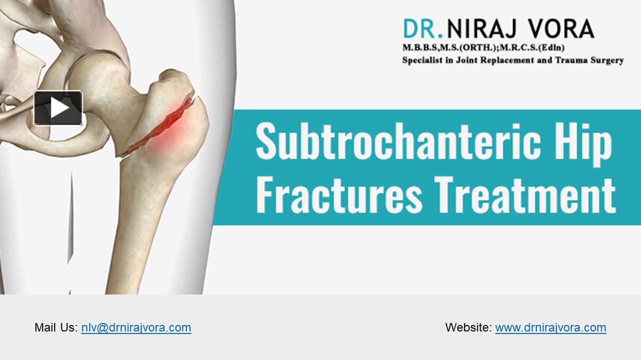 Subtrochanteric Hip Fractures Treatment | Dr Niraj Vora presentation ...