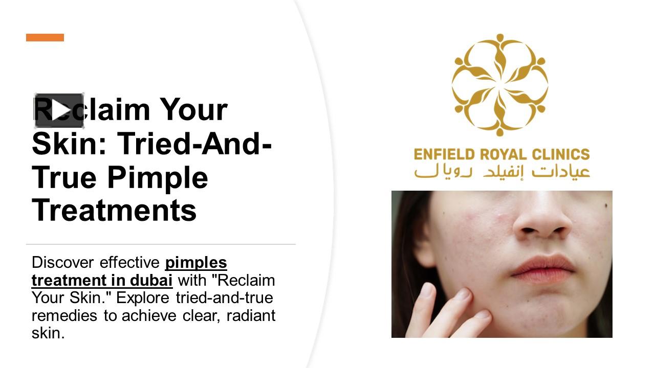 PPT – Reclaim Your Skin: Tried-And-True Pimple Treatments PowerPoint ...