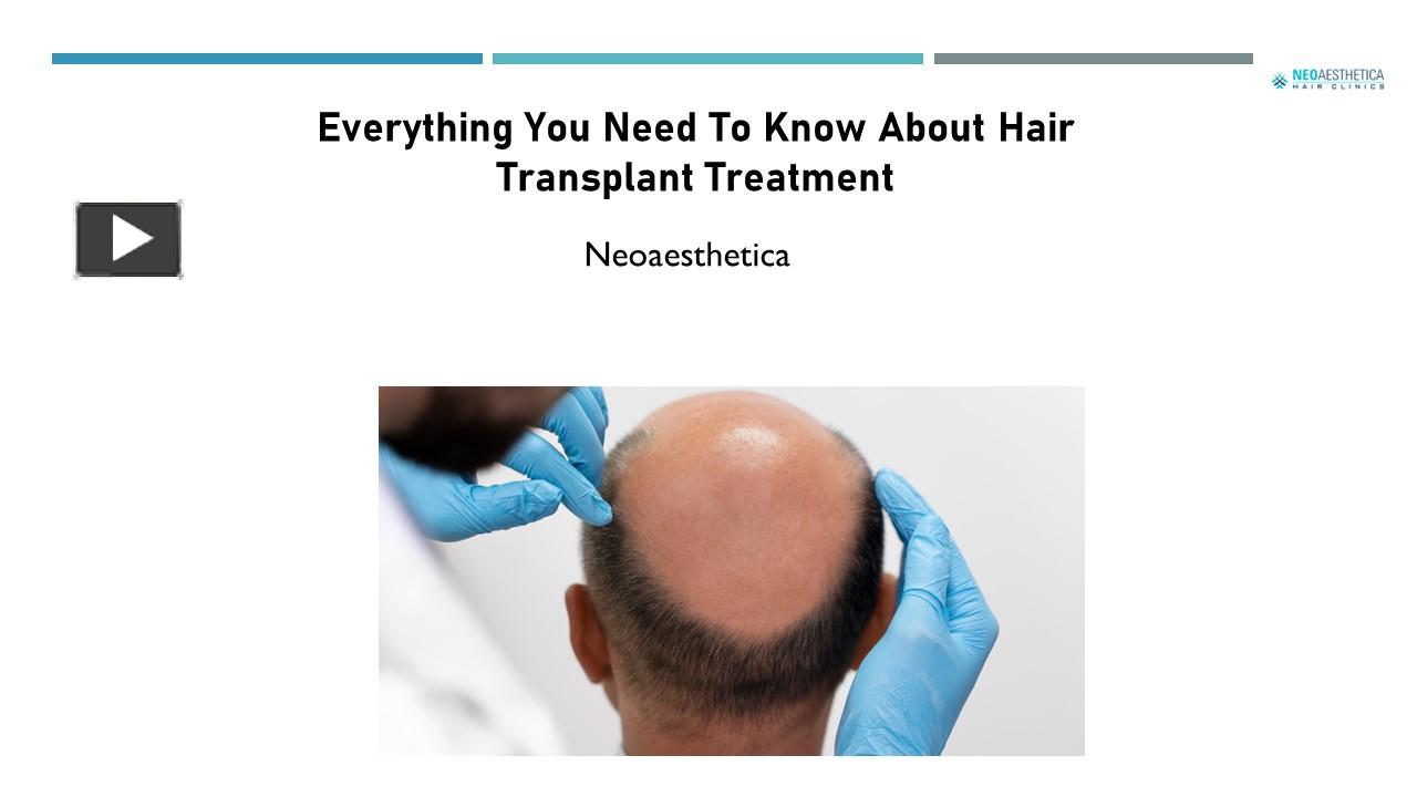 PPT – Everything You Need To Know About Hair Transplant Treatment (1 ...