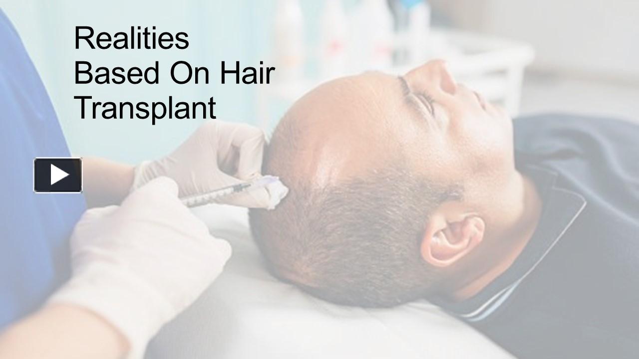 PPT – Realities Based On Hair Transplant PowerPoint presentation | free ...