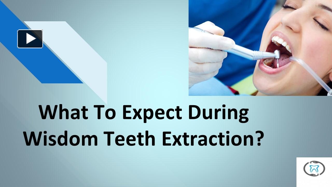PPT – What To Expect During Wisdom Teeth Extraction? PowerPoint ...