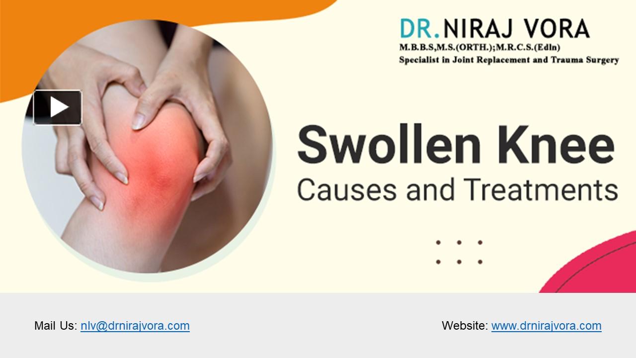 PPT – Swollen Knee Causes and Treatment | Dr Niraj Vora PowerPoint ...