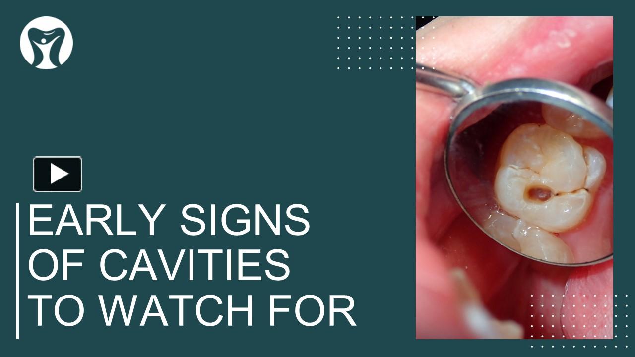 PPT – Spotting Cavities: Early Warning Signs for Dental Health ...