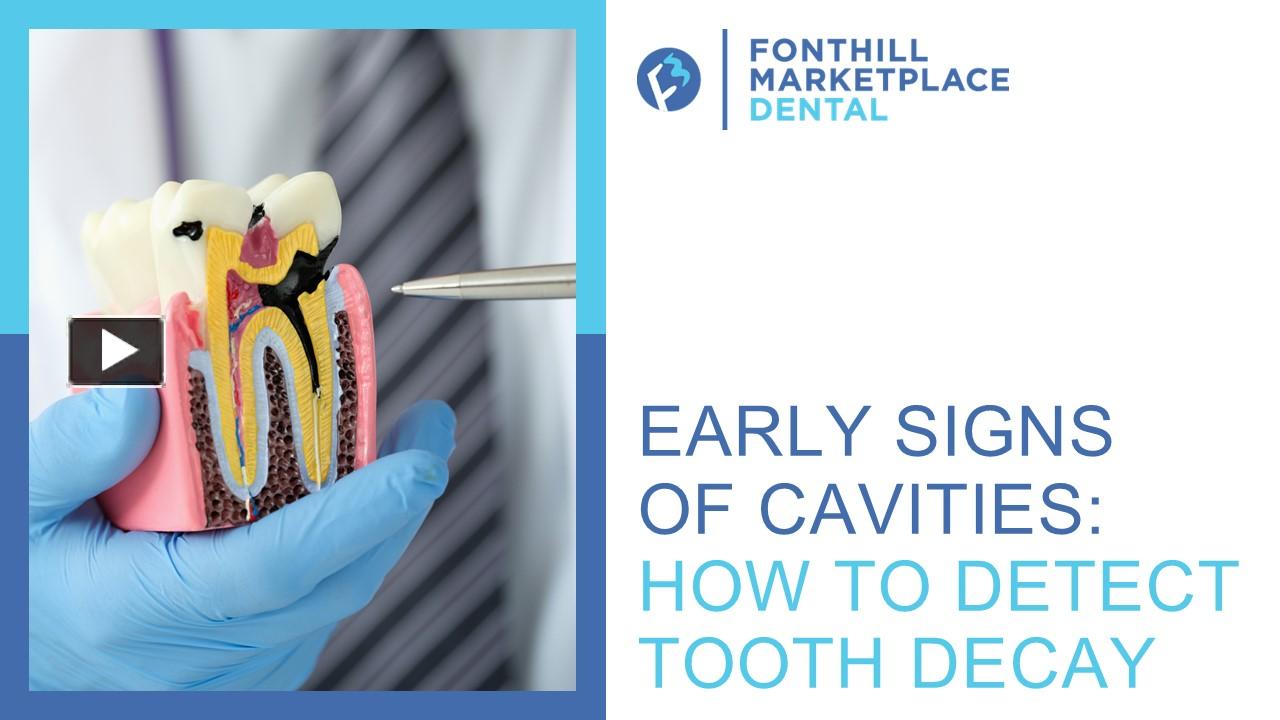 Early Signs of Cavities: How to Detect Tooth Decay presentation | free ...