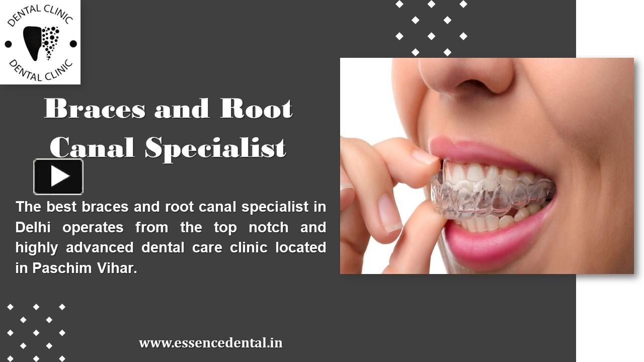 Braces and Root Canal Specialist (1) presentation | free to download