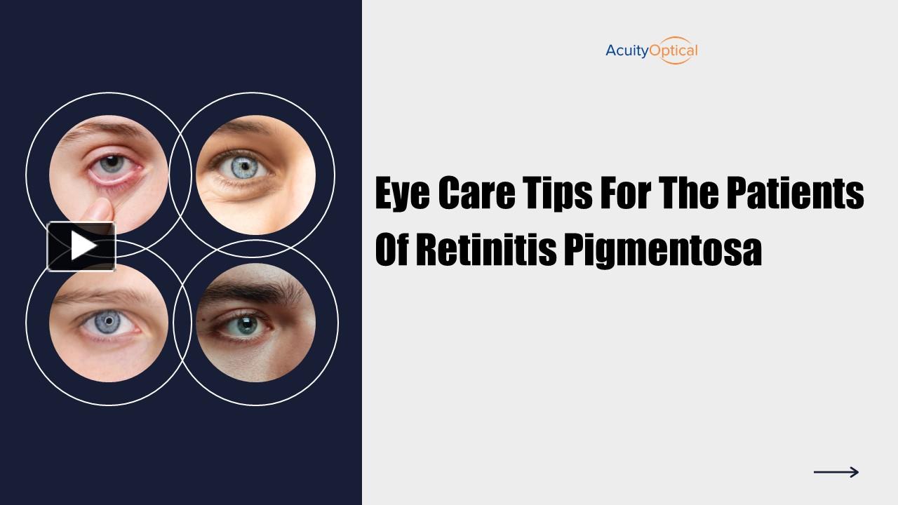 PPT – Eye Care Tips For The Patients Of Retinitis Pigmentosa PowerPoint ...