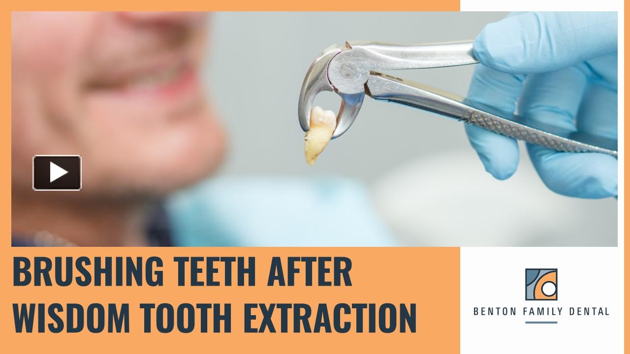 PPT – Post-Wisdom Tooth Extraction Oral Care: Brushing Teeth the Right ...