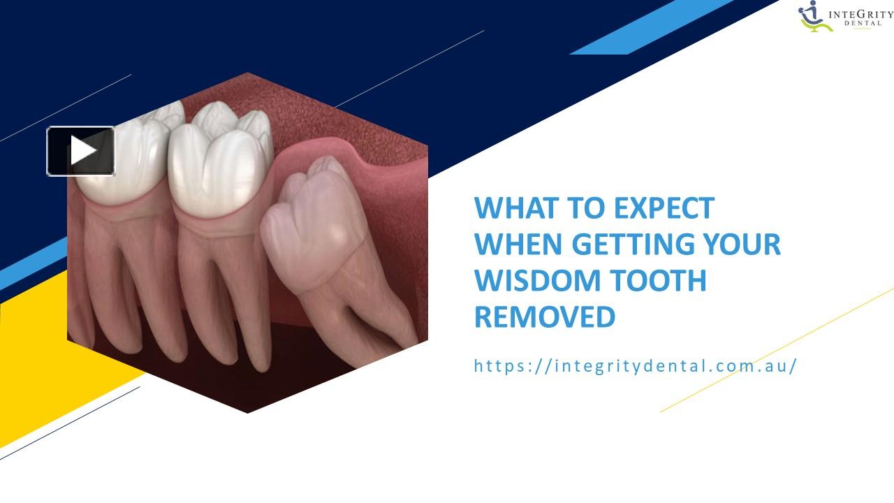 Wisdom Tooth: Unraveling the Mysteries and Unveiling presentation ...