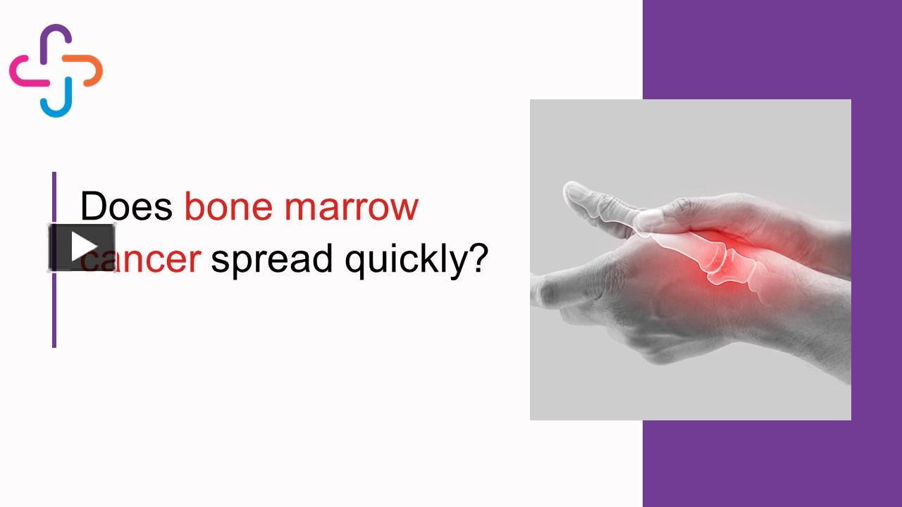 PPT – Does bone cancer spread quickly ? PowerPoint presentation | free ...