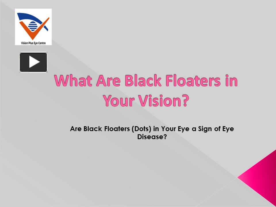 What Are Black Floaters in Your Vision? presentation | free to download