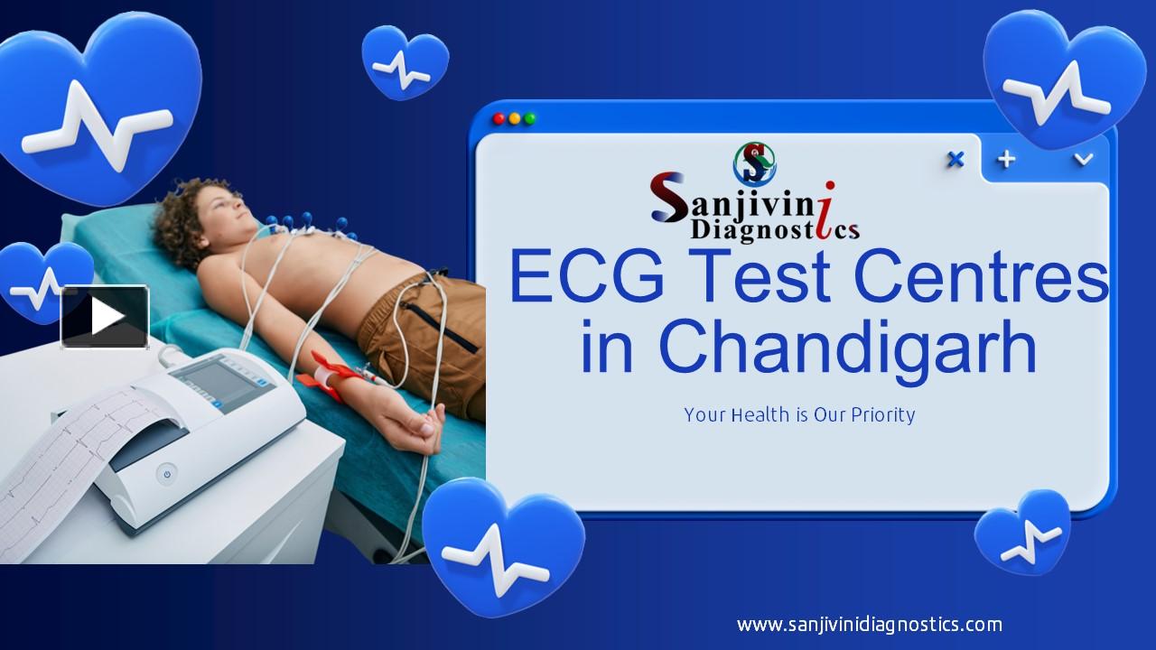 PPT – ECG Test Centers in Chandigarh - Sanjivini Diagnostics PowerPoint ...