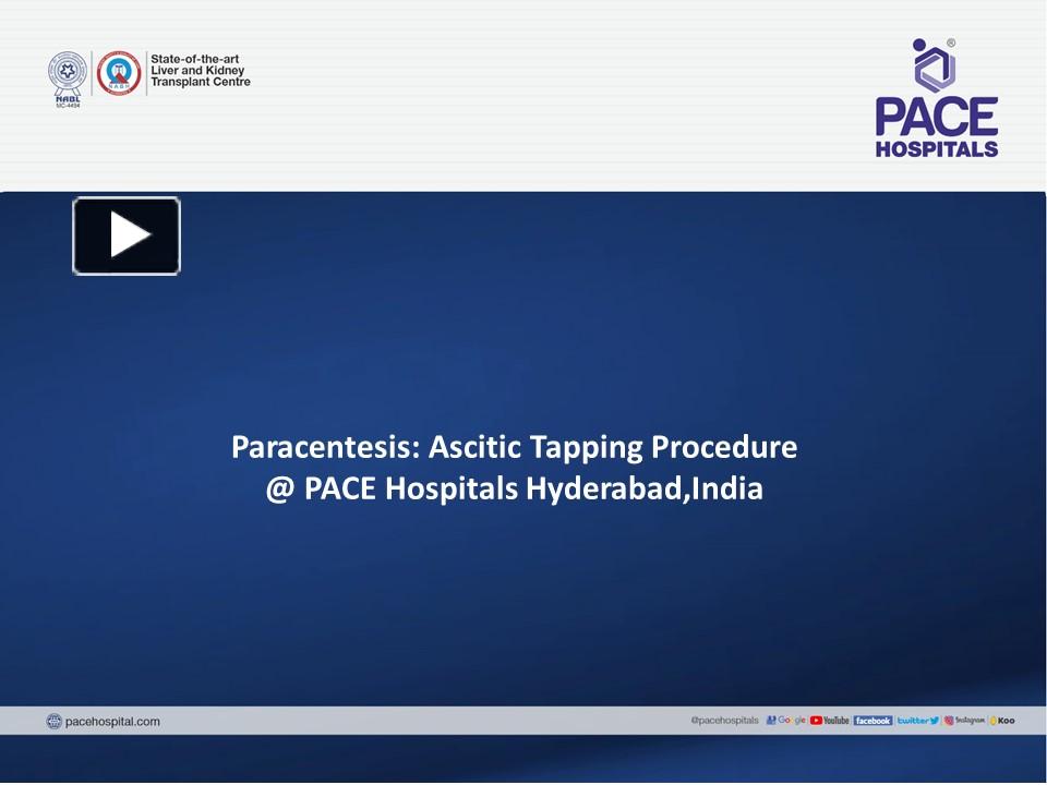 Paracentesis, Ascitic Tapping Procedure - Indications & Cost ...