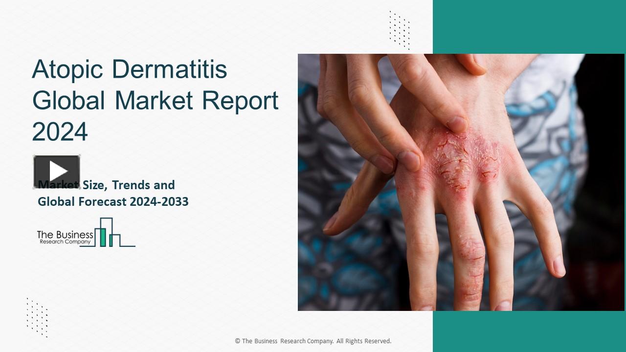 Atopic Dermatitis Market Growth Trajectory Through 2024-2033 ...