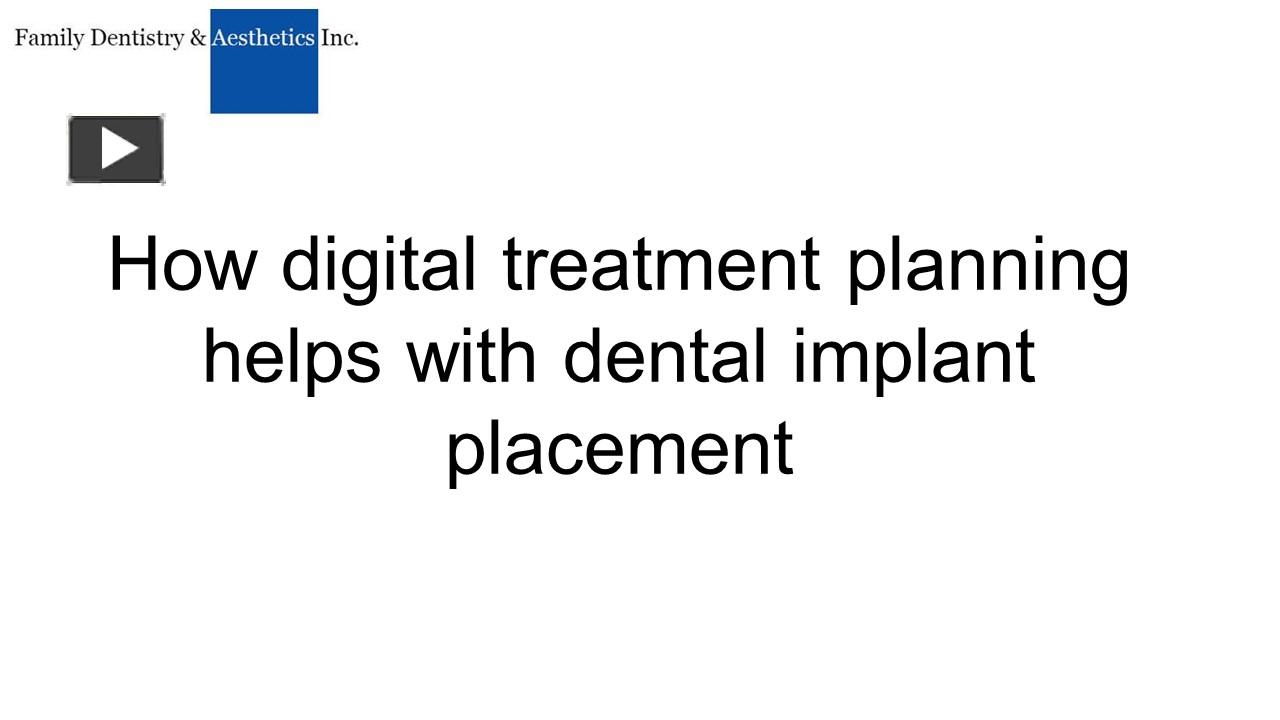 How digital treatment planning helps with dental implant placement ...