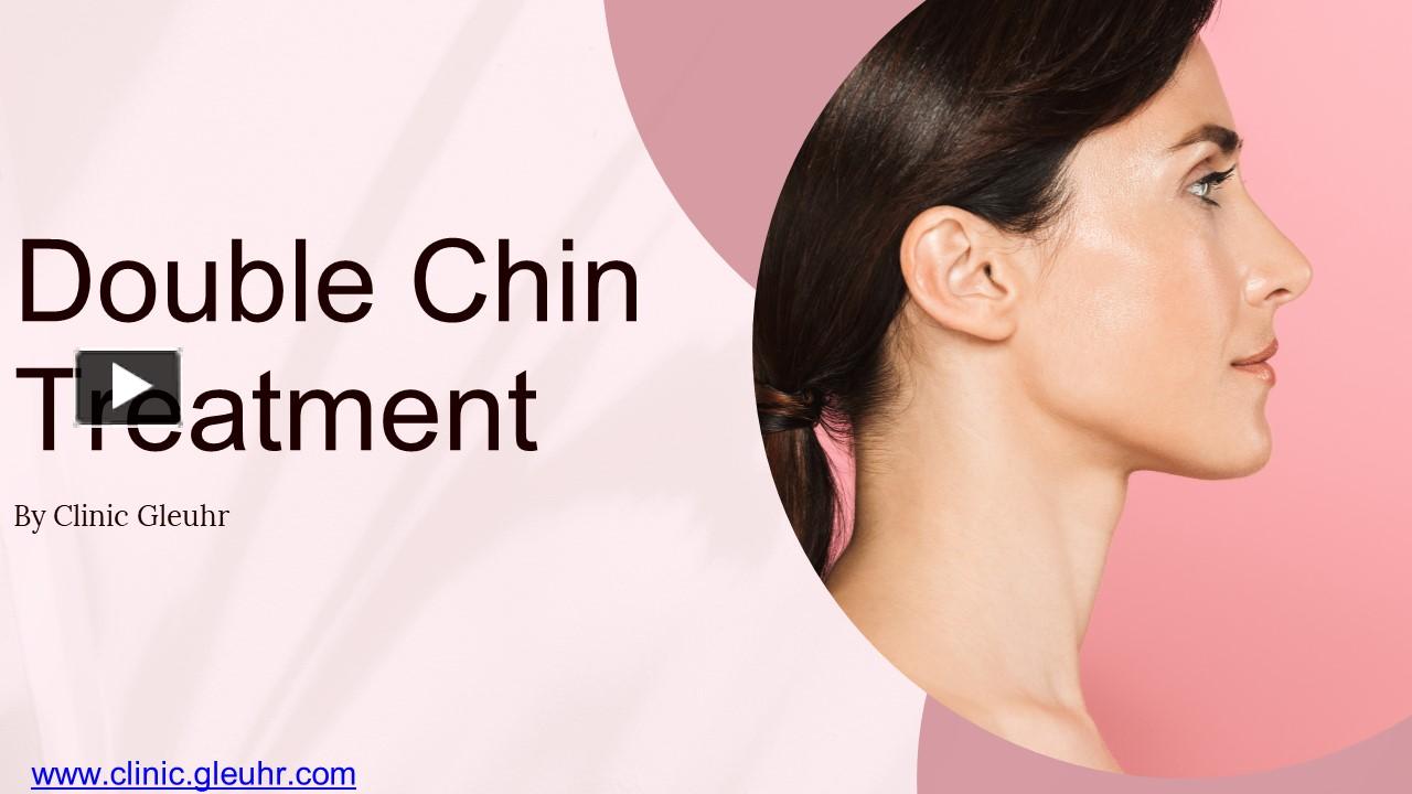 What is Double Chin Treatment? presentation | free to download