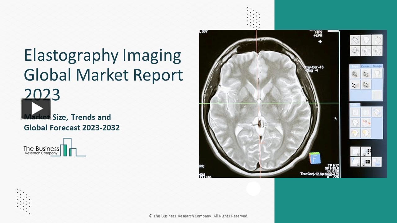 PPT – Elastography Imaging Market Share Analysis, Growth Trends 2023 ...