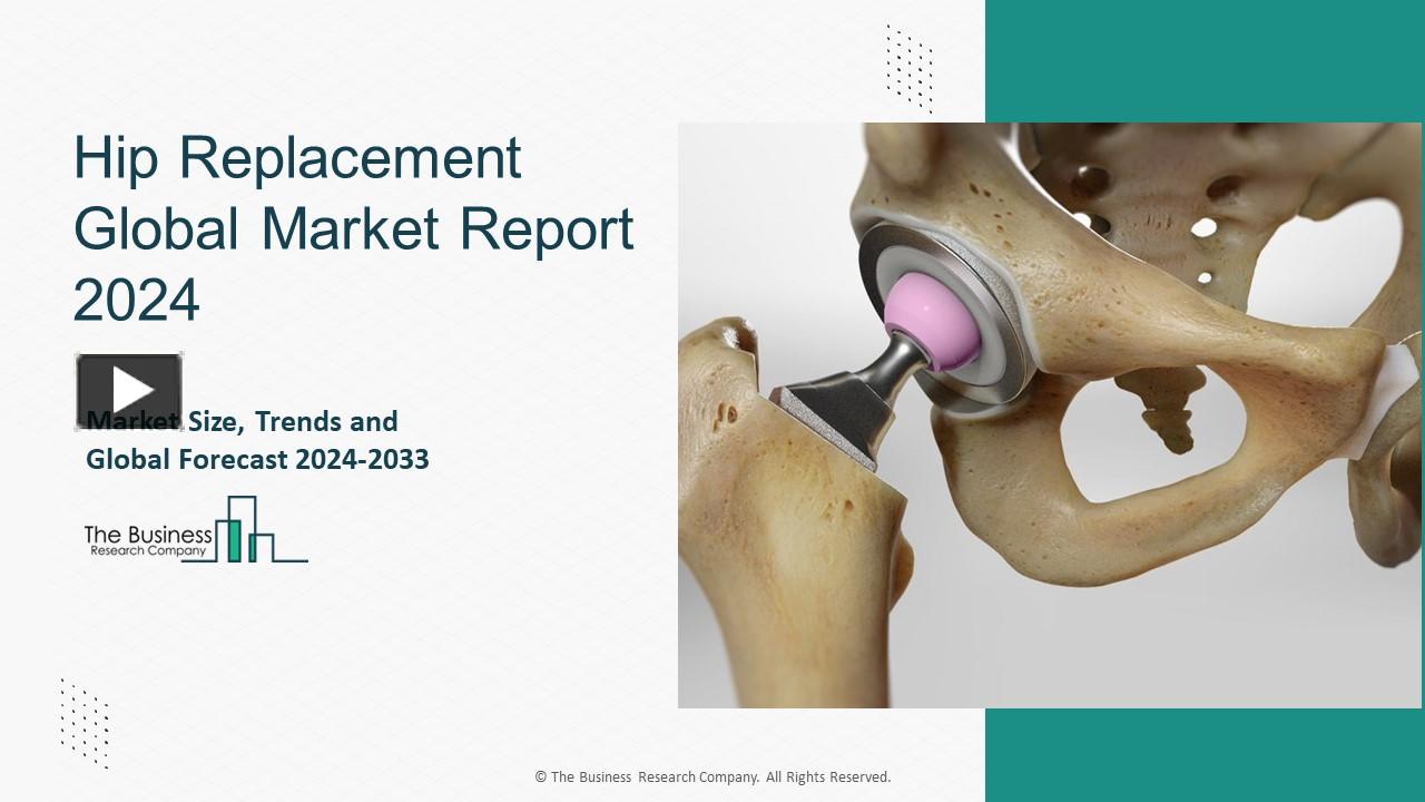 PPT – Hip Replacement Market Growth Trajectory Through 2024-2033 ...