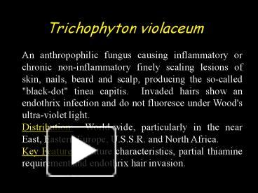PPT – Trichophyton violaceum PowerPoint presentation | free to view ...