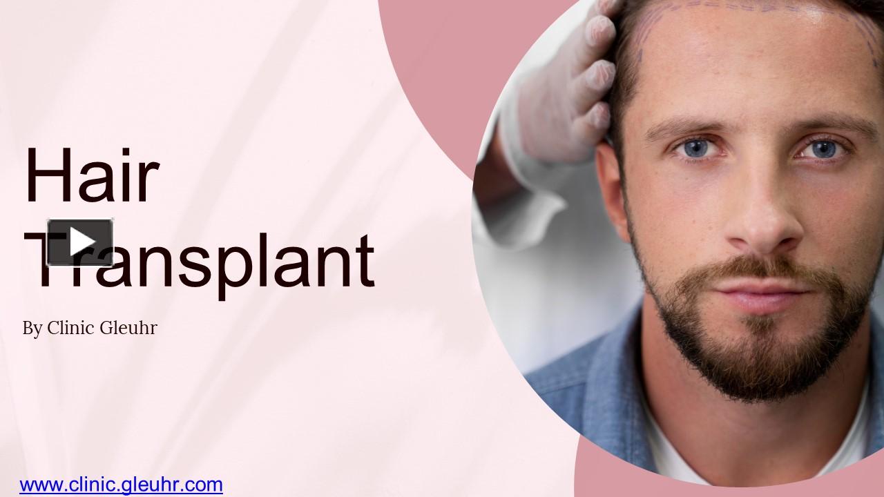 PPT – What is hair transplant? PowerPoint presentation | free to ...