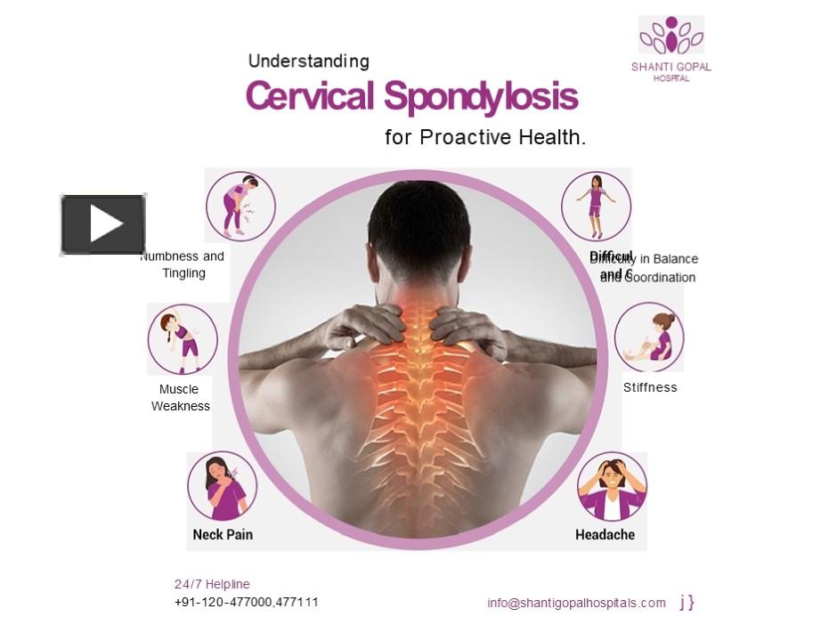 Proactive Health Management: Understanding Cervical Spondylosis at ...