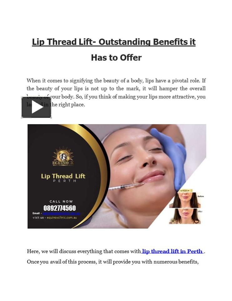 Lip Thread Lift - Elevate Your Lip Appearance with Subtle Yet Impactful ...