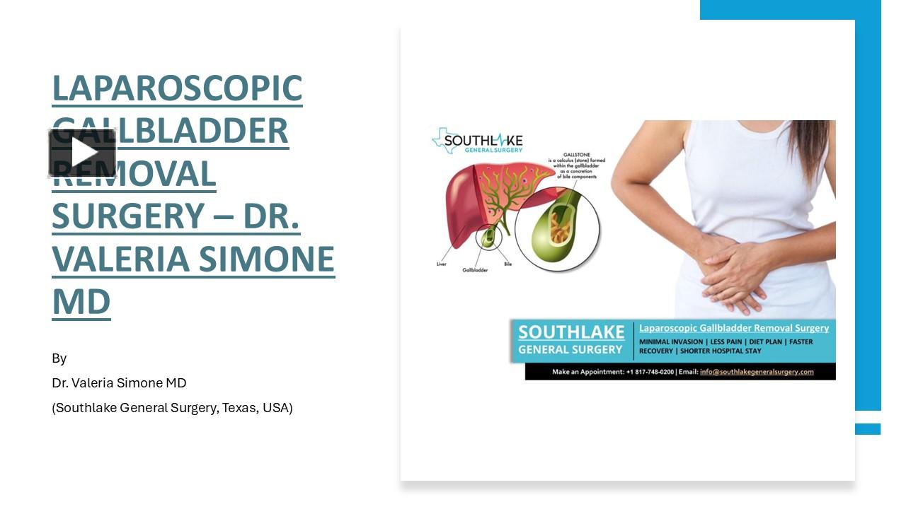PPT – Laparoscopic Gallbladder Removal Surgery – Dr. Valeria Simone MD ...