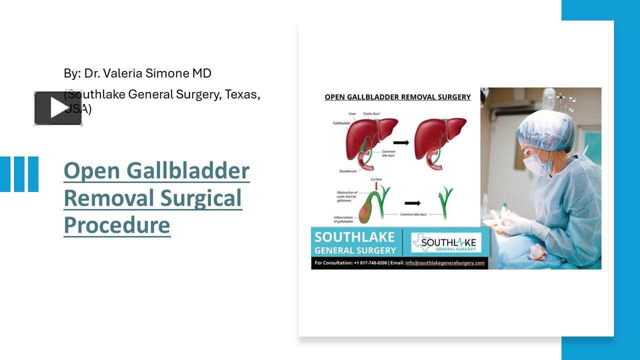 Open Gallbladder Removal Surgical Procedure presentation | free to download