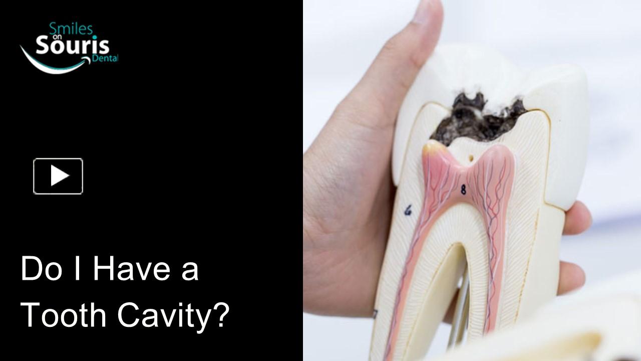Detecting Tooth Cavities: A Guide to Understanding Your Oral Health ...