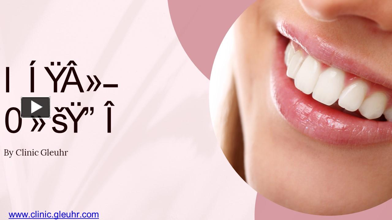 What is Smile Design? presentation | free to download