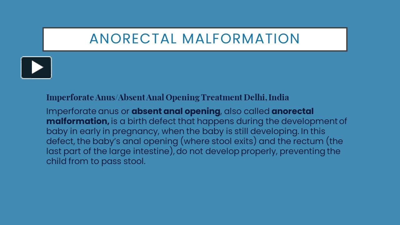 Anorectal Malformation presentation | free to download