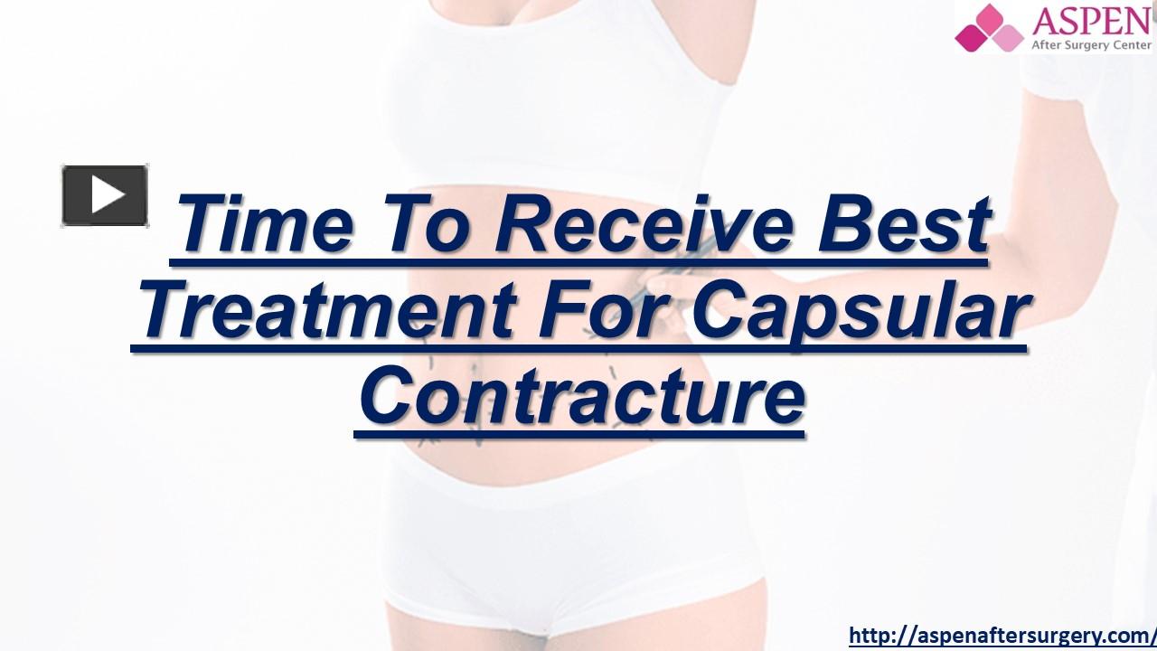 Time To Receive Best Treatment For Capsular Contracture presentation ...