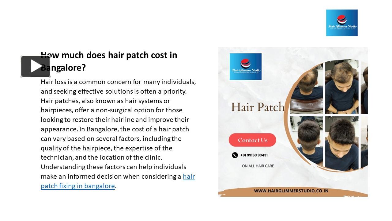 PPT – How much does hair patch cost in Bangalore? PowerPoint ...