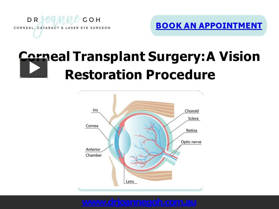 Corneal Transplant Surgery: A Vision Restoration Procedure presentation ...
