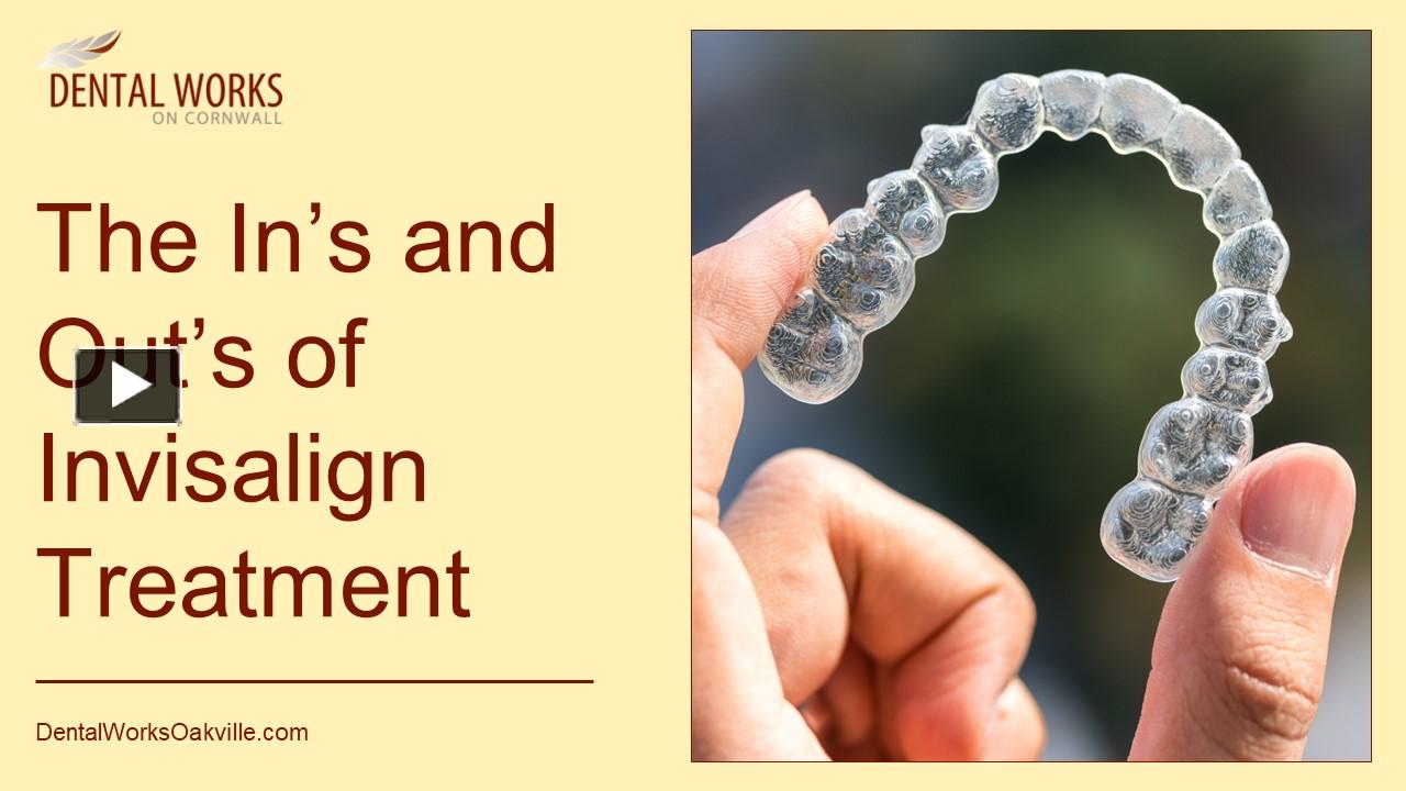 The Ins and Outs of Invisalign Treatment presentation | free to download