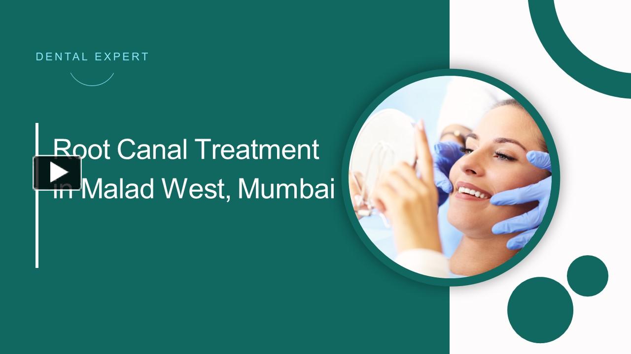 PPT – Root Canal Surgeon in Malad West PowerPoint presentation | free ...