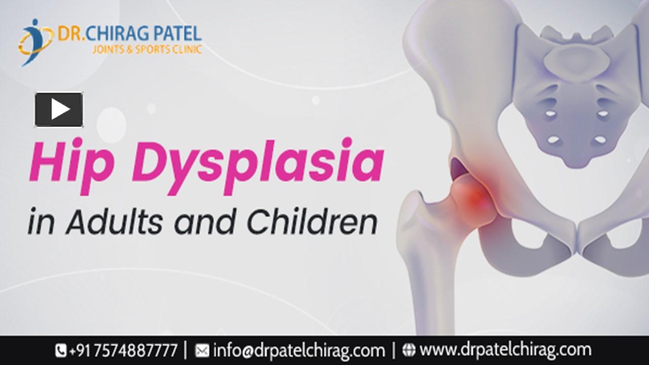 Understanding Hip Dysplasia in Adults and Children | Dr. Chirag Patel ...