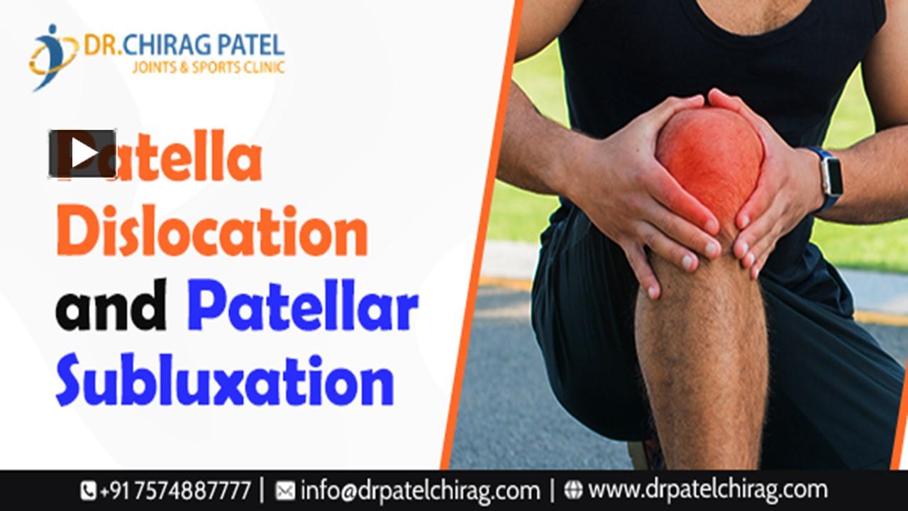 Insights into Patella Dislocation and Patellar Subluxation | Dr. Chirag ...