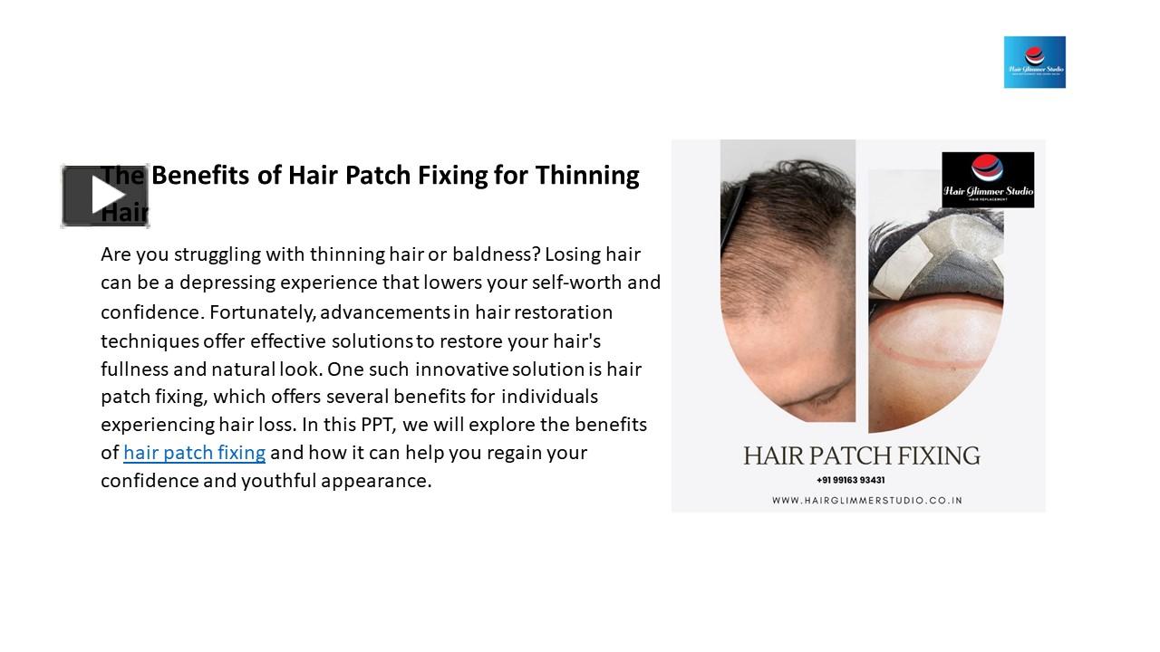 PPT – The Benefits of Hair Patch Fixing for Thinning Hair PowerPoint ...