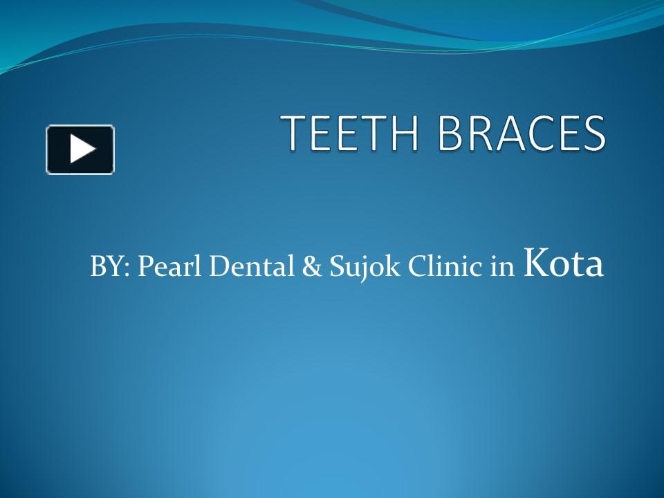 Teeth Braces Presentation Free To Download