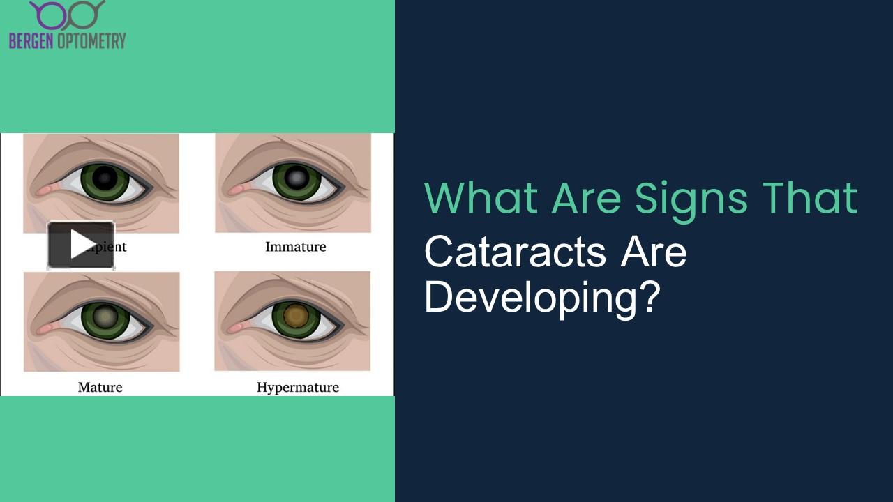 PPT – What Are Signs That Cataracts Are Developing PowerPoint ...