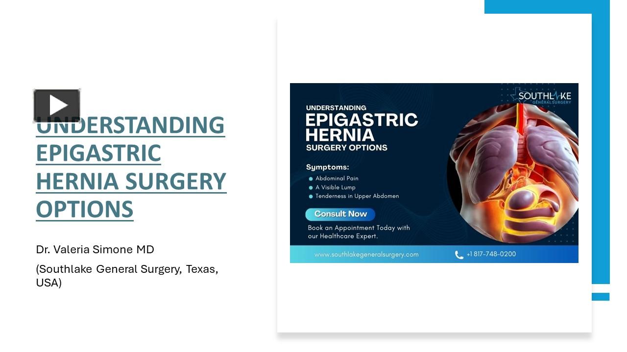 Understanding Epigastric Hernia Surgery Options presentation | free to ...