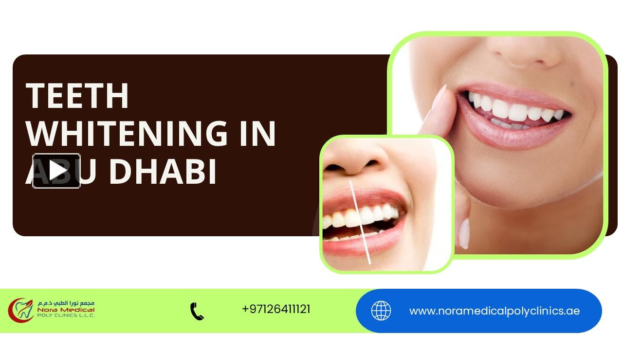 PPT – Teeth Whitening in Abu Dhabi PowerPoint presentation | free to ...