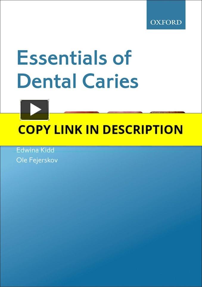 PPT – Download Essentials of Dental Caries Full PowerPoint presentation ...