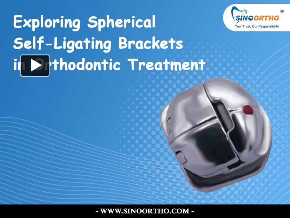 PPT – Exploring Spherical Self-Ligating Brackets in Orthodontic ...