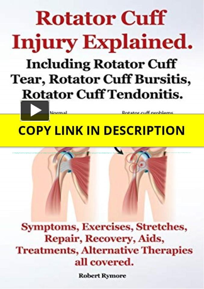 PPT – (PDF) Rotator Cuff Injury Explained. Including Rotator Cuff Tear ...