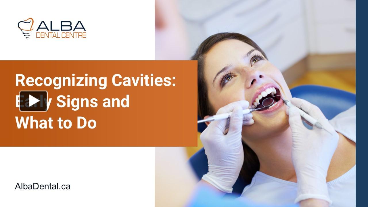 PPT – Key Signs of Developing Cavities PowerPoint presentation | free ...