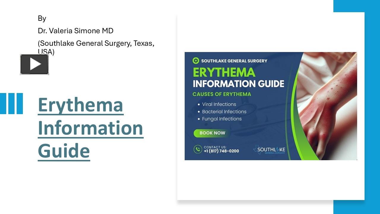 Erythema Information Guide presentation | free to download