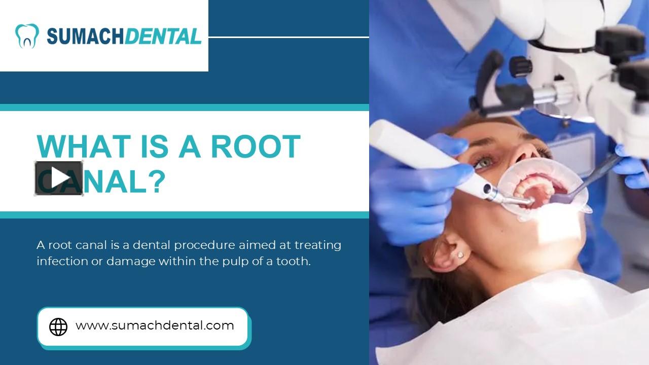 PPT – What is a Root Canal and Root Canal in Toronto PowerPoint ...