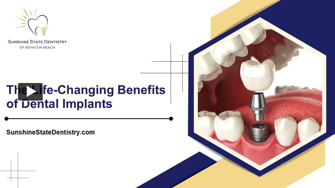 Ppt Discovering The Advantages Of Dental Implants Powerpoint